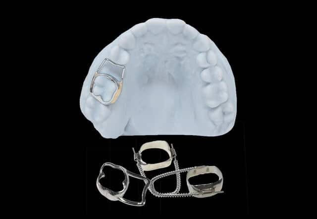 Space Maintainer - VTA Dental Lab