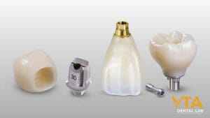 What Is A Custom Abutment? Benefits And Technology Behind It - VTA ...