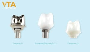 The Dental Abutment Placement Process: Steps To Success In Implant ...